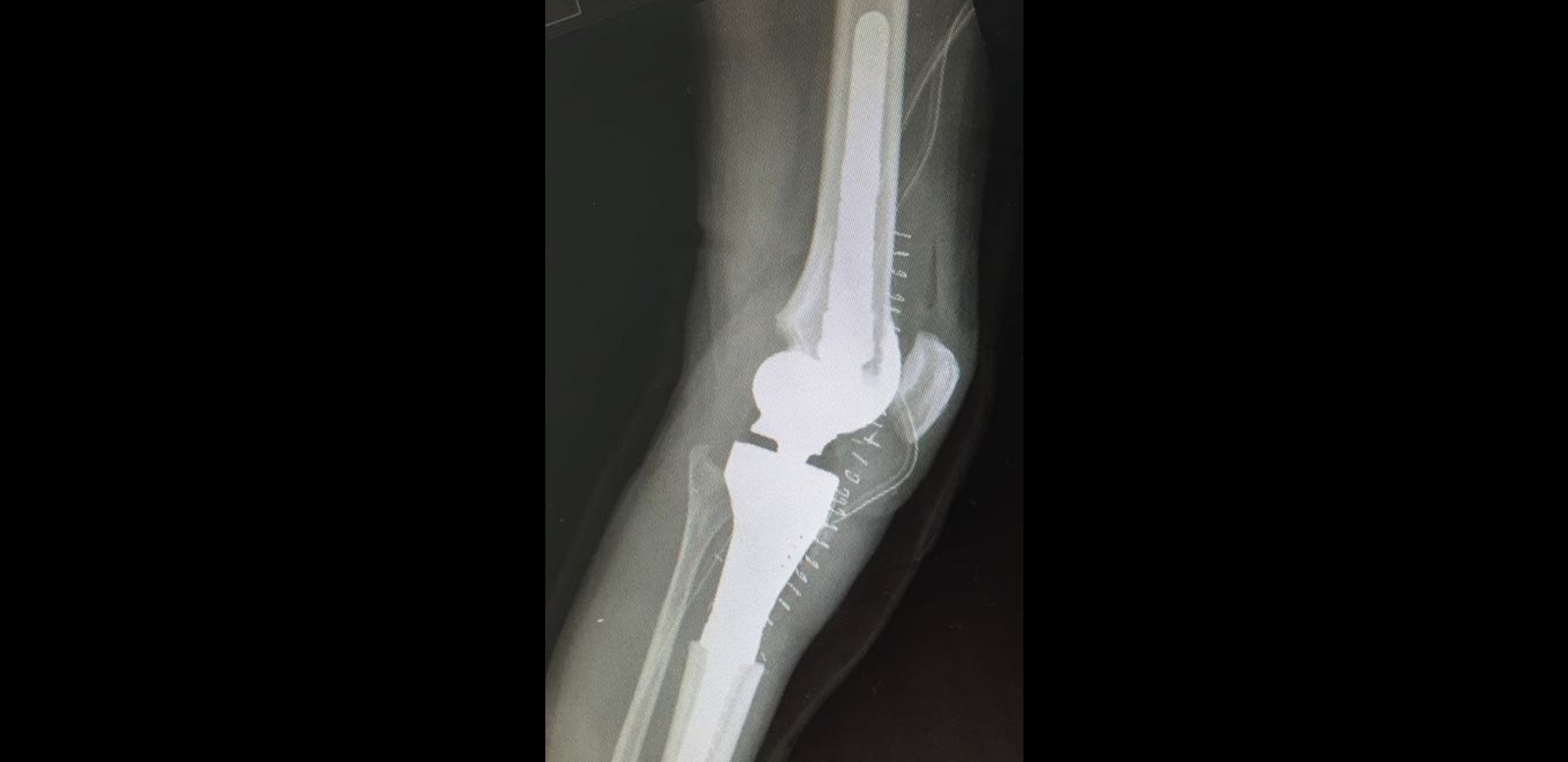 Gallery | Joint and Bone Solutions